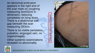 recurrent choledocholithiasis | PPT