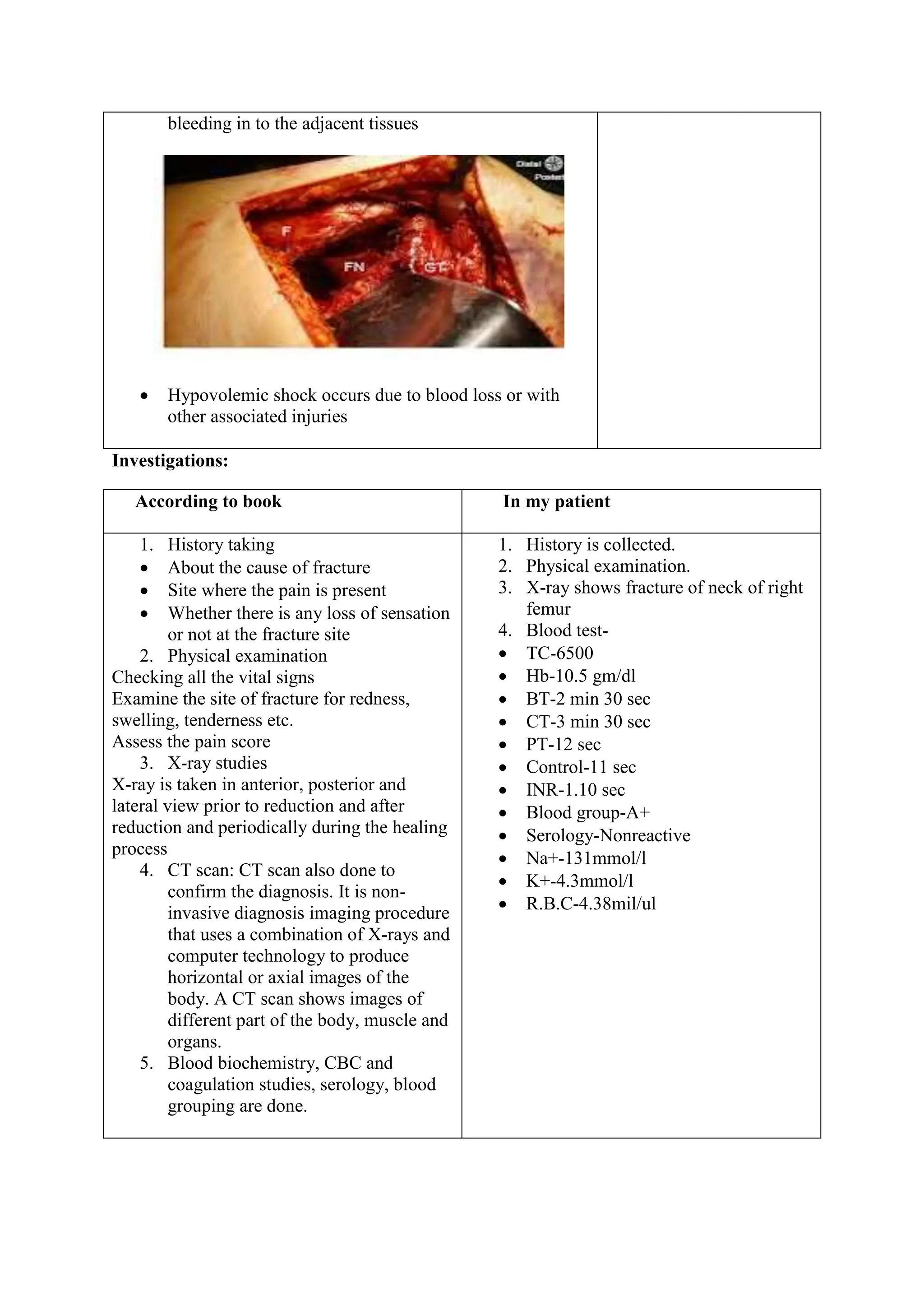 A complete case presentation on hip fracture. | DOCX