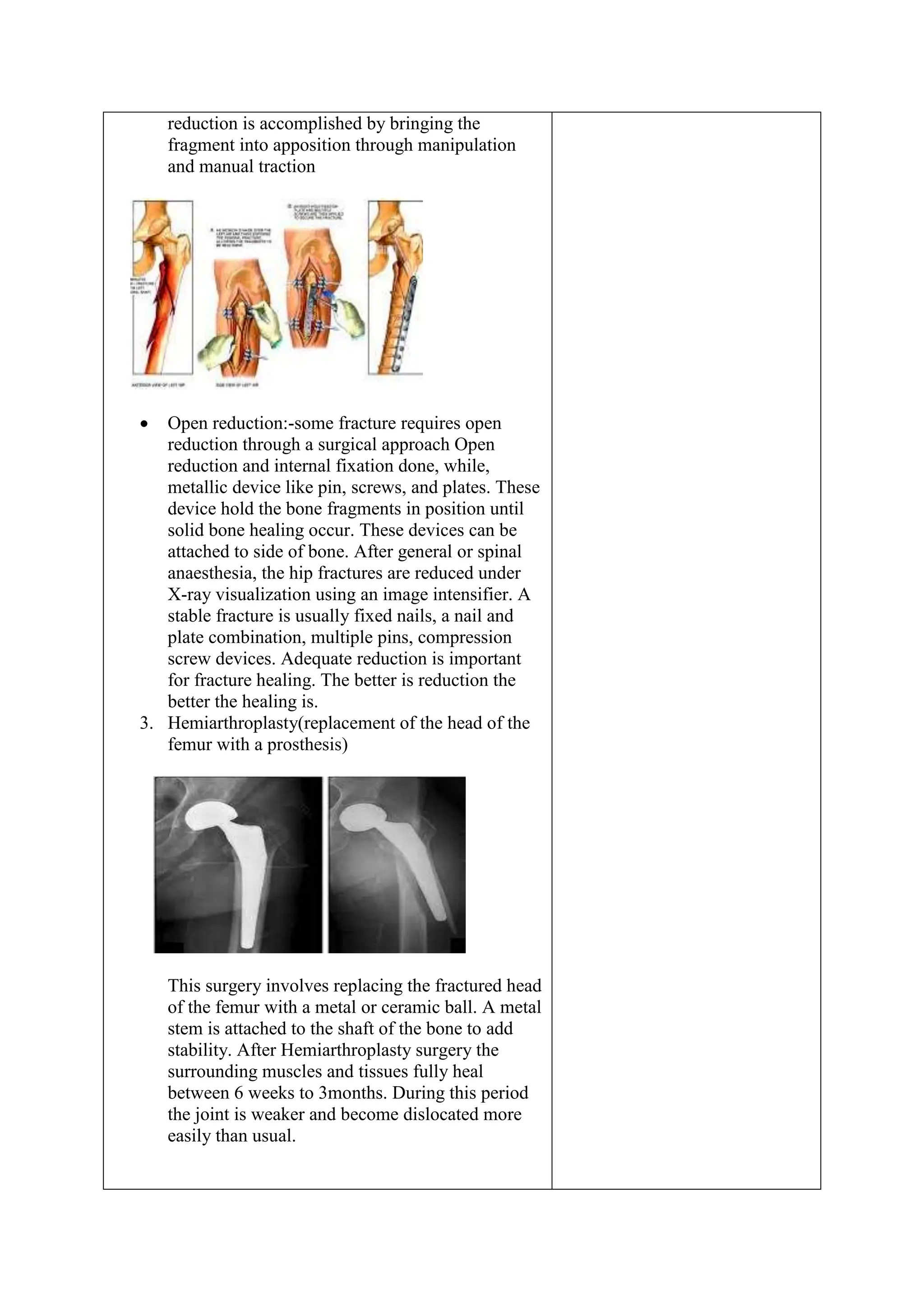 A complete case presentation on hip fracture. | DOCX