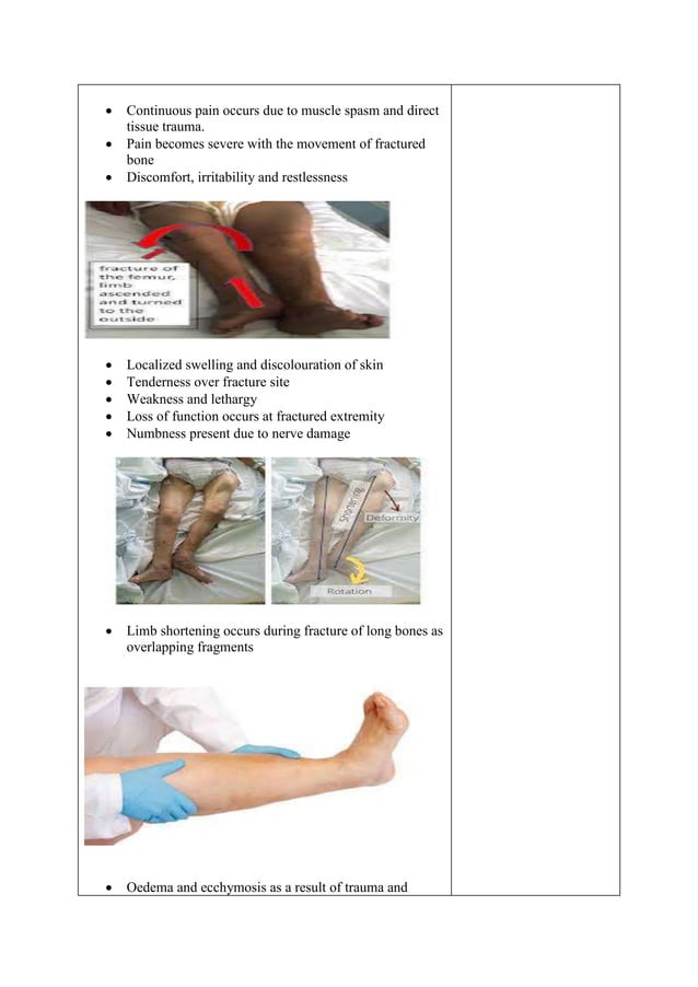 A complete case presentation on hip fracture. | DOCX
