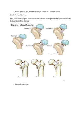 A complete case presentation on hip fracture. | DOCX