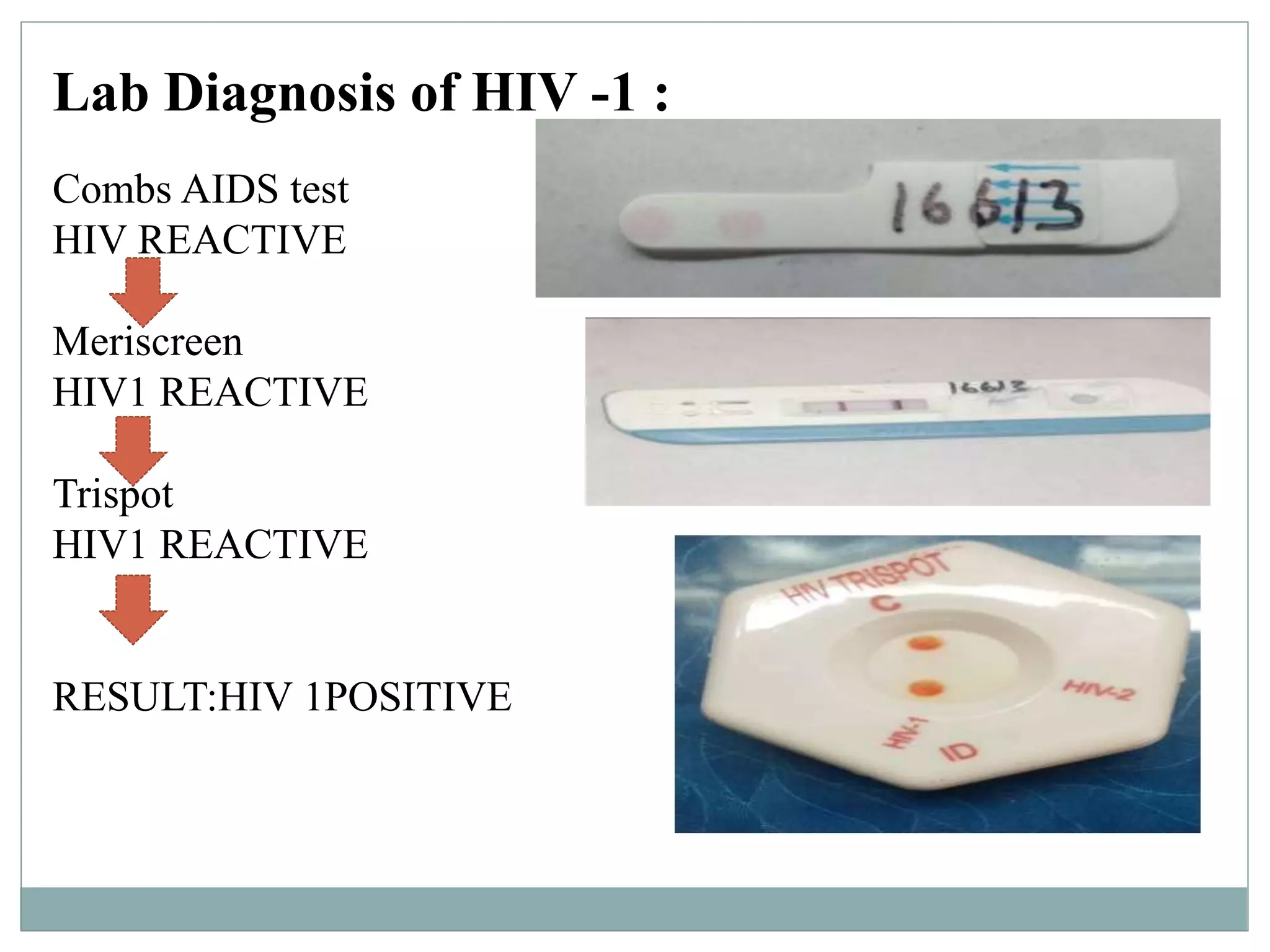Case presentation hiv 1 male | PPTX