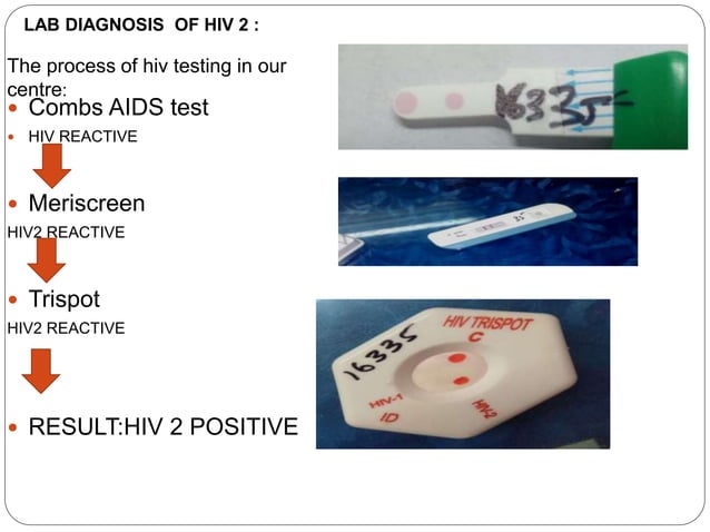 Case presentation hiv 2 | PPT