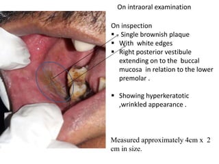 Case presentation hyperkeratotic lession | PPTX