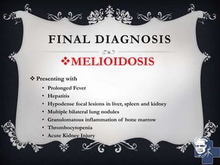 Melioidosis - a disease deserving strong clinical suspicion | PPTX