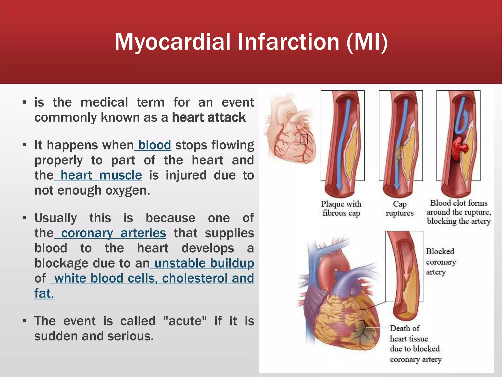Case presentation myocardial infarction | PPTX