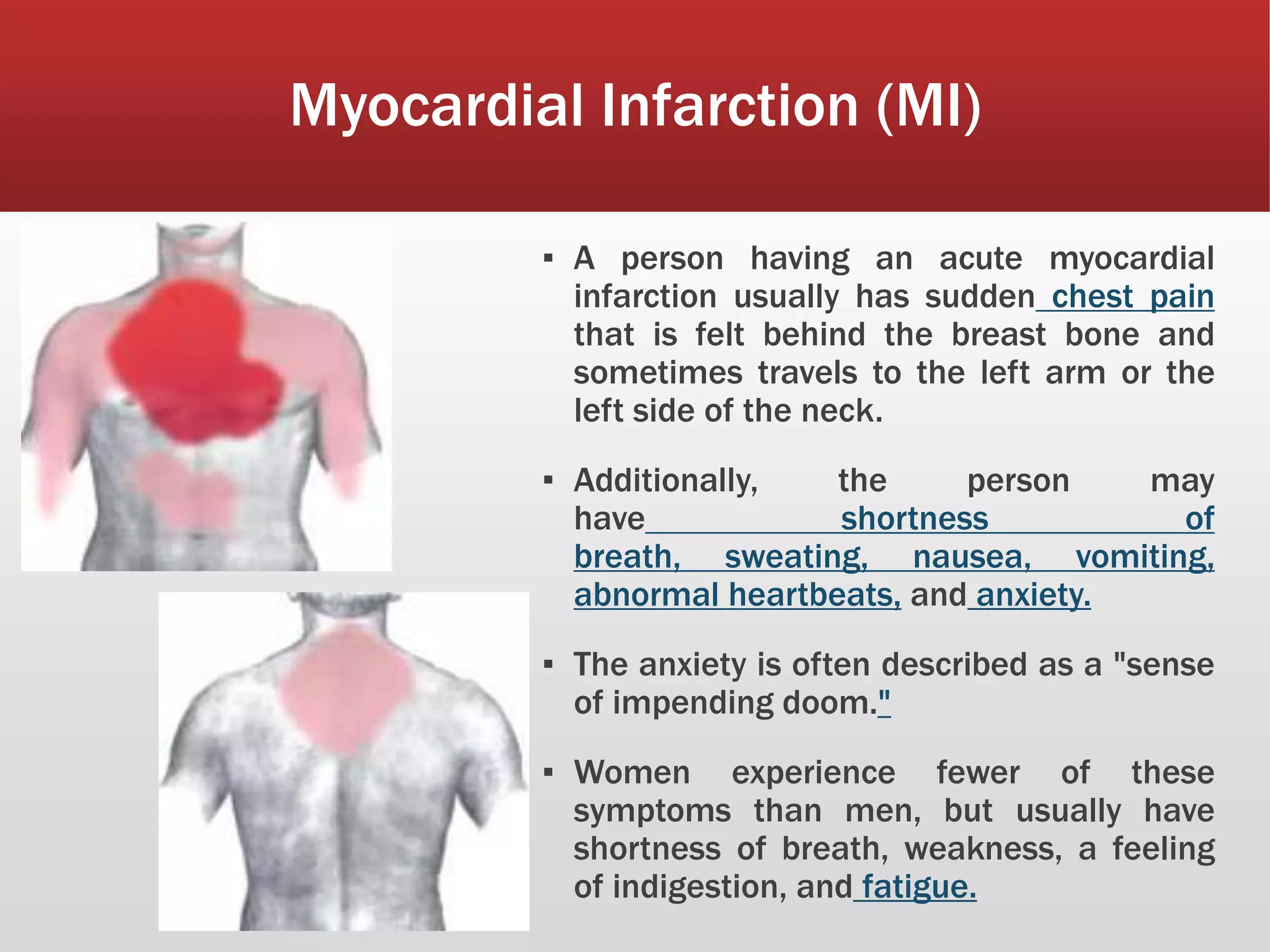 Case presentation myocardial infarction | PPTX