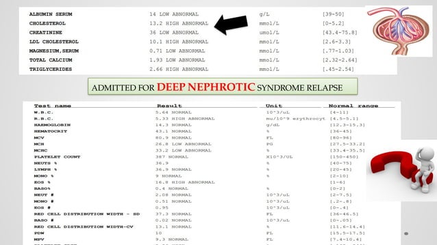case presentation Nephrotic Syndrome.pptx