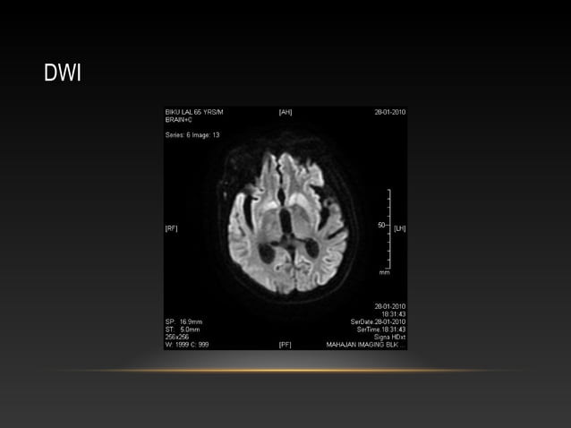 Case presentation neurology | PPT