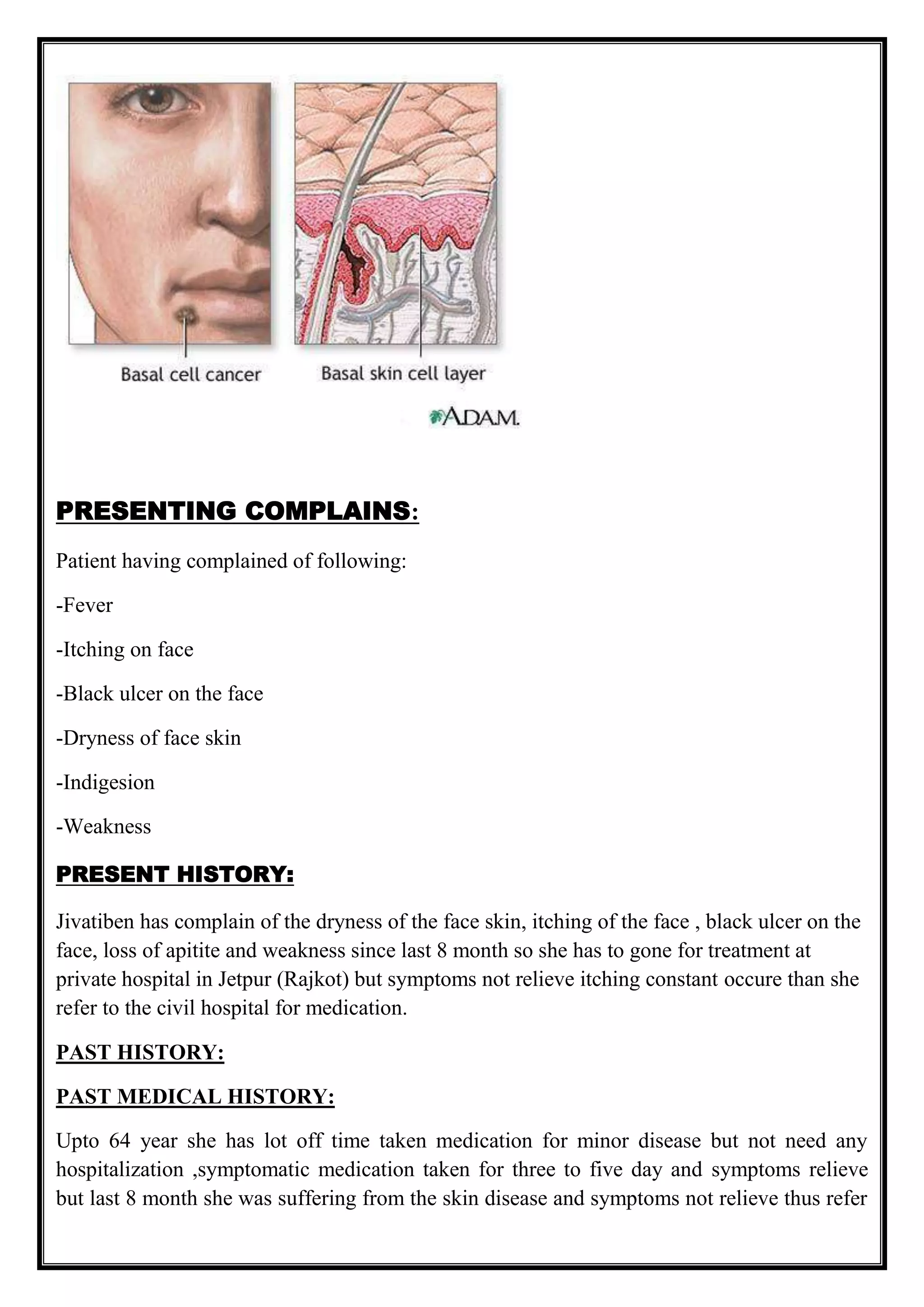 Case presentation of basal cell carcinoma of face no 4 | DOCX