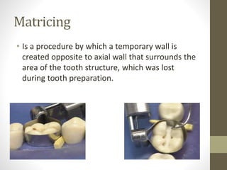 Case presentation of dislodged class 2 composite filling.pptx