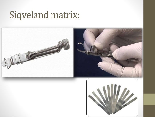 Case presentation of dislodged class 2 composite filling.pptx