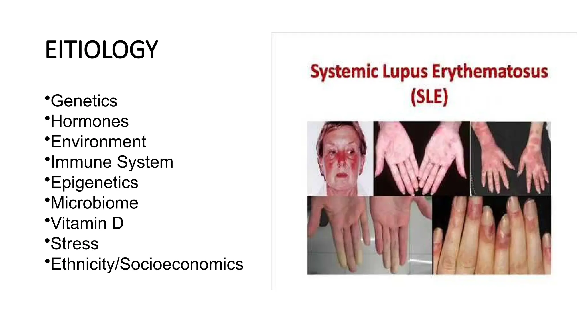 CASE PRESENTATION ON SYSTEMIC LUPUS ERYTHEMATOUS.pptx