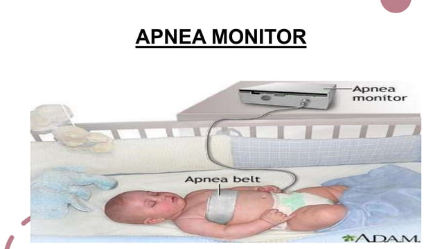Case presentation on Neonatal Apnea | PPTX | Pregnancy | Reproductive ...
