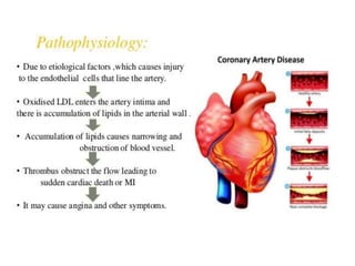 Case presentation on coronary artery disease | PPTX