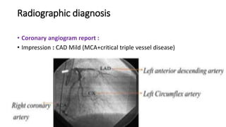 case presentation on coronary artery disease. | PPTX