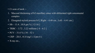 Case presentation on eagle syndrome.pptx