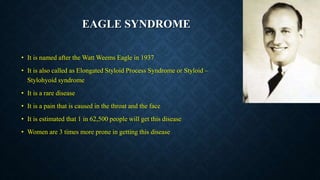 Case presentation on eagle syndrome.pptx