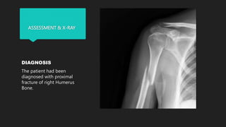 CASE PRESENTATION ON FRACTURE OF HUMERUS.pptx