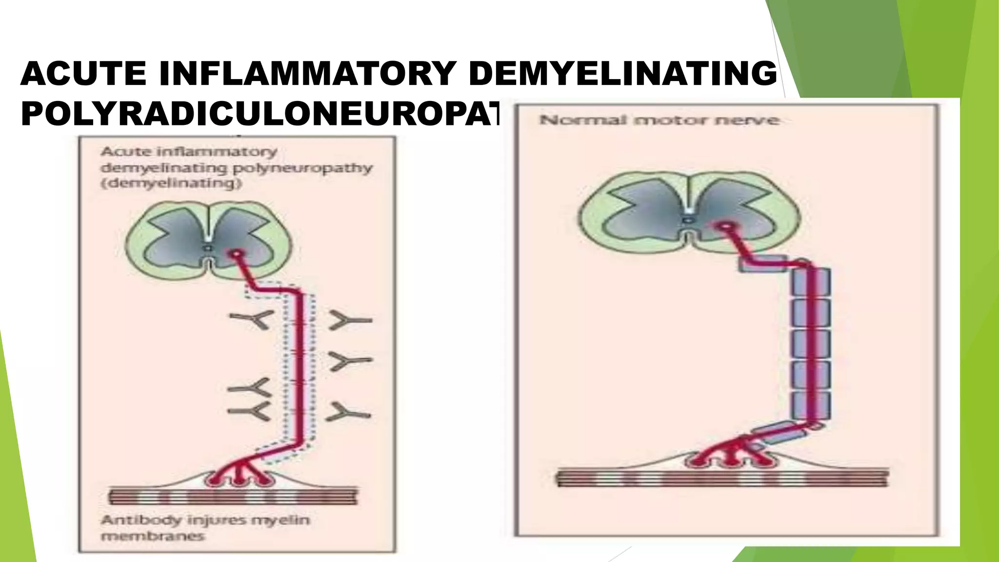 Case presentation on Guillain-Barré syndrom |neuromuscular disorder | PPTX