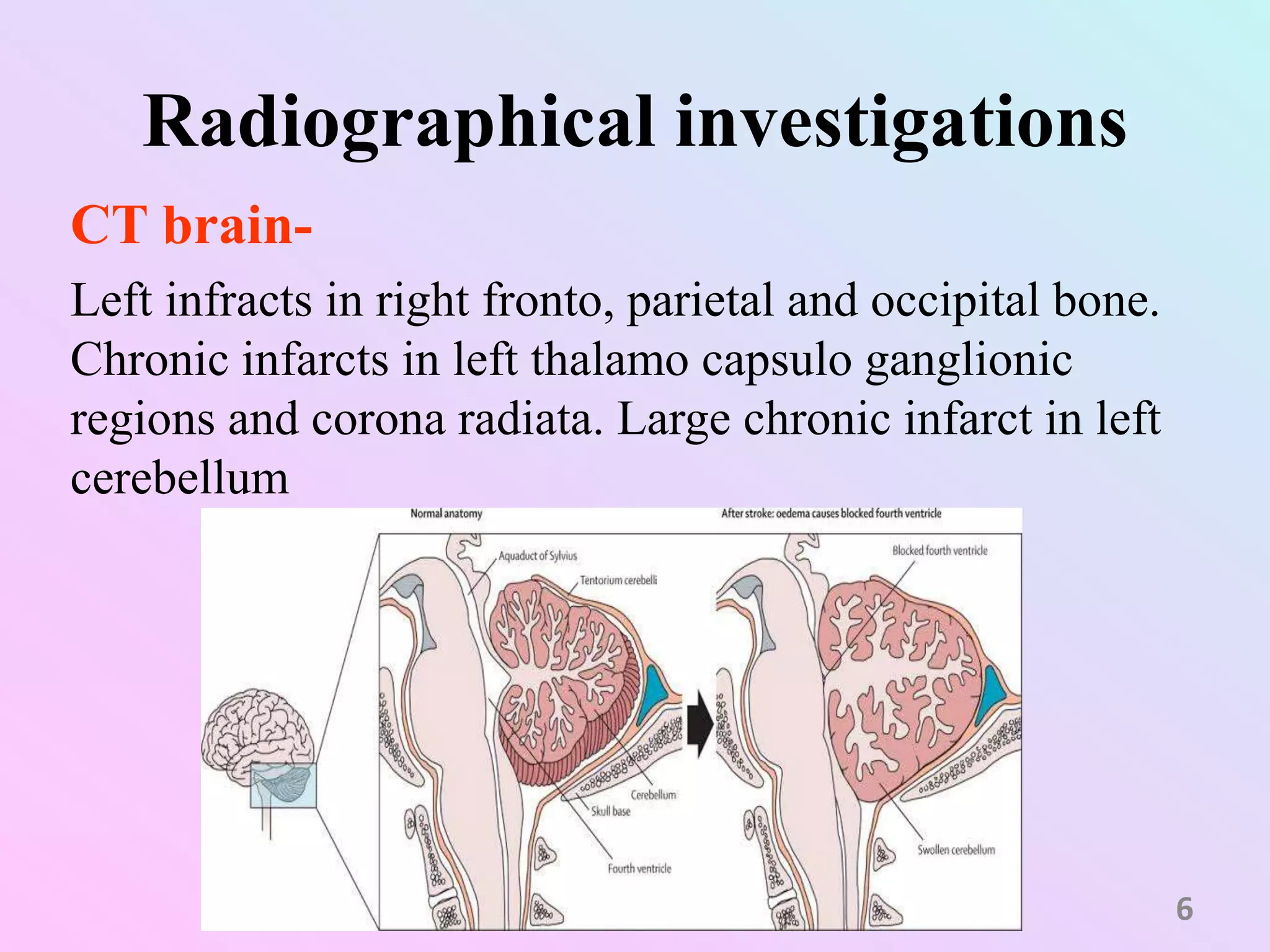 Case presentation on hemiplegia | PPTX