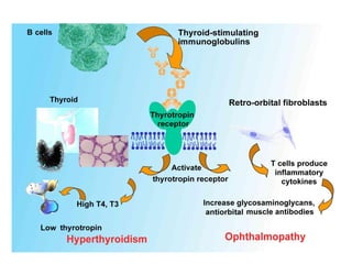 Case presentation on hyperthyroidism | PDF | Thyroid Disorders | Endocrine and Metabolic Diseases