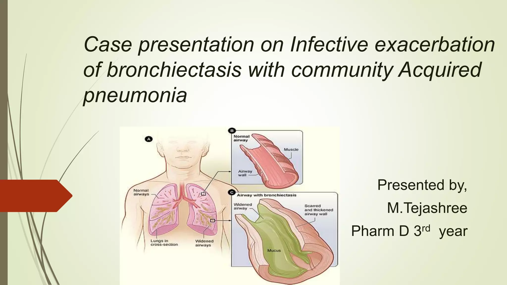 Case presentation on bronchiectasis with community acquired pneumonia | PPTX