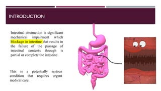 CASE PRESENTATION on Intestinal Obstruction.pptx