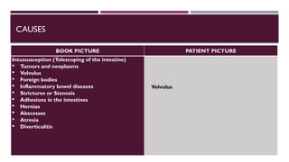 CASE PRESENTATION on Intestinal Obstruction.pptx