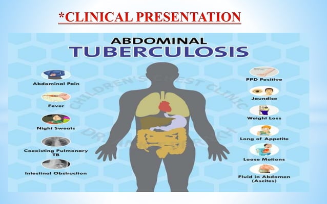 Case presentation on intestinal tuberculosis | PPTX | Digestive ...