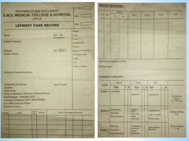 Leprosy: Case Presentation , Facts & Management | PPTX