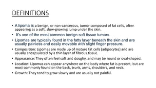 CASE PRESENTATION ON LIPOMA OVER LEFT THIGH BY DR. JESMINA KHATUN | PPT