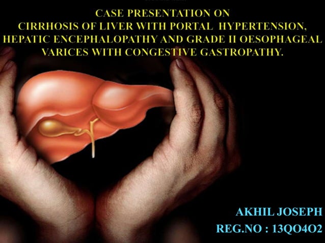 CASE PRESENTATION ON CIRRHOSIS OF LIVER WITH PORTAL HYPERTENSION ...