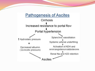 Portal Hypertension Ascites