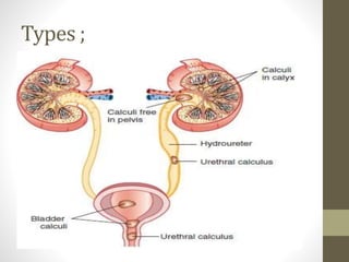 Case presentation on renal caliculi | PPT