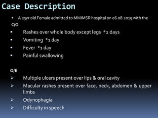 Case presentation on sjs | PPTX