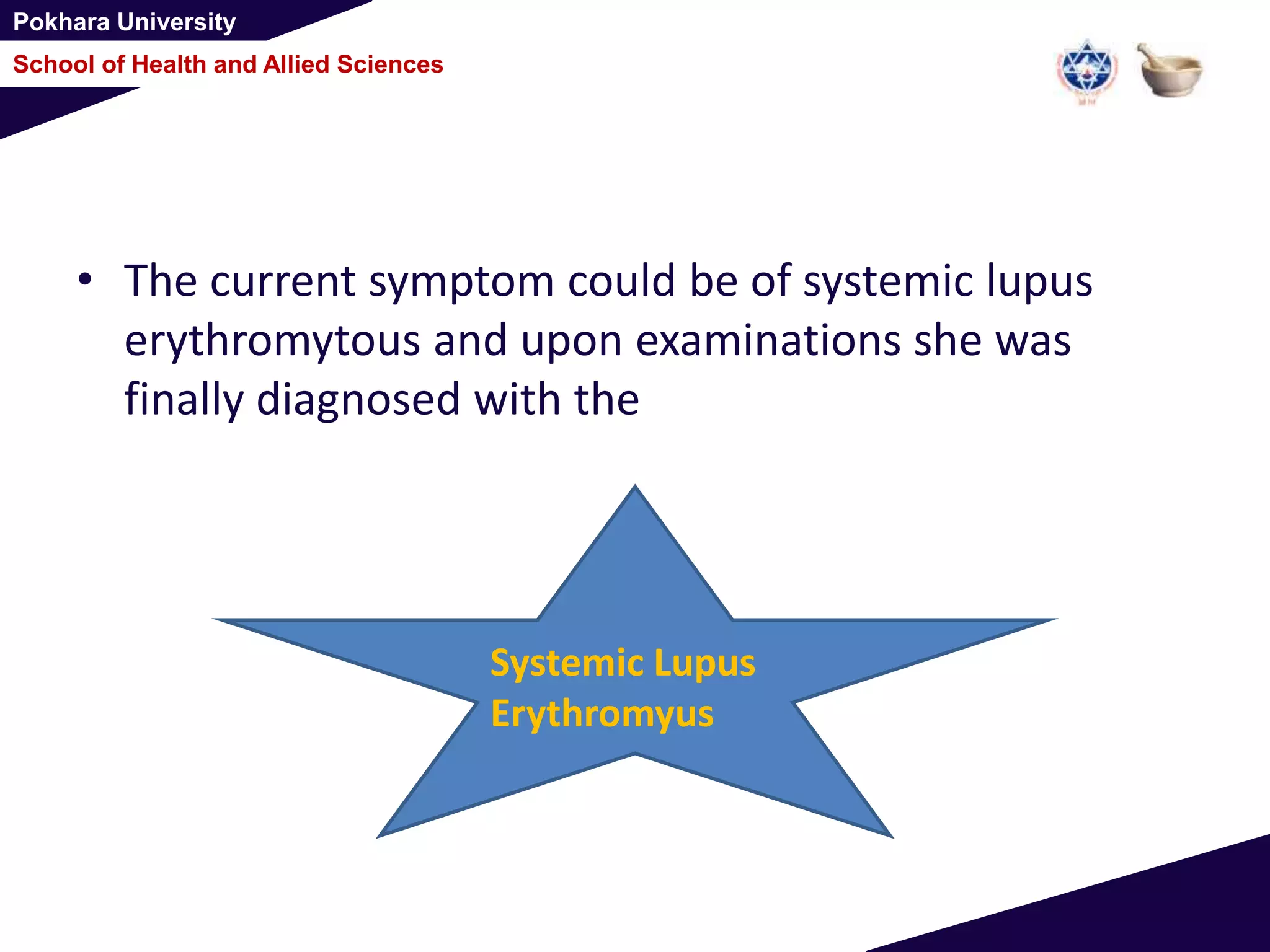 Case presentation on sle | PPTX