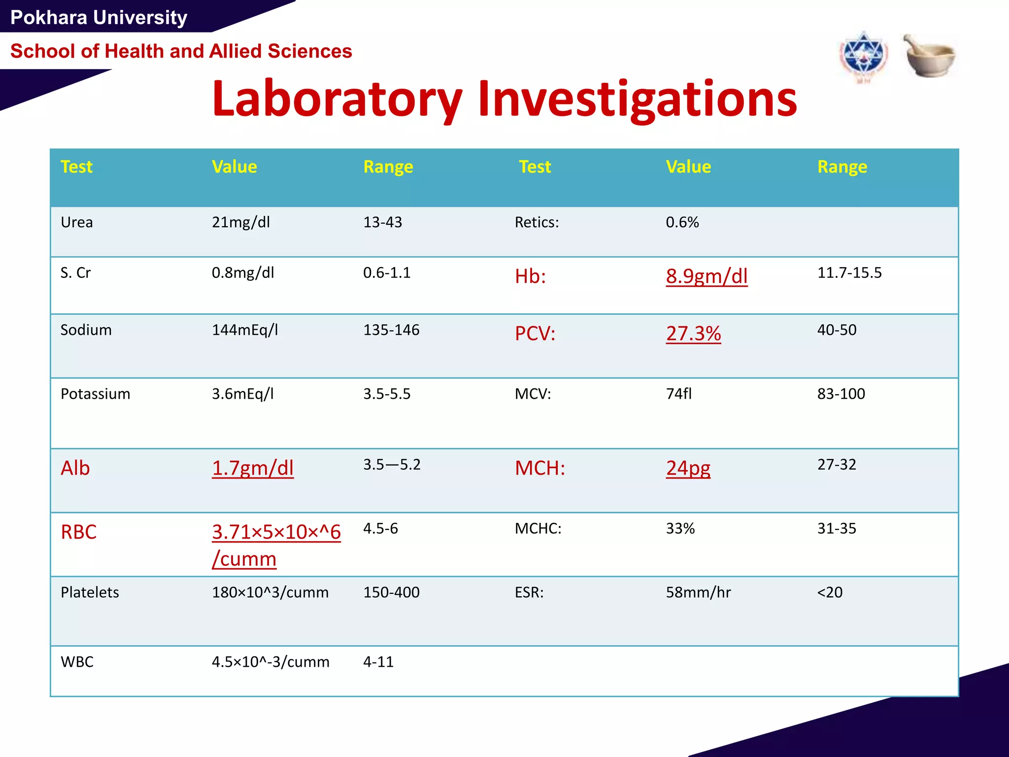 Case presentation on sle | PPTX