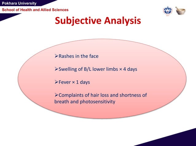 Case presentation on sle | PPTX