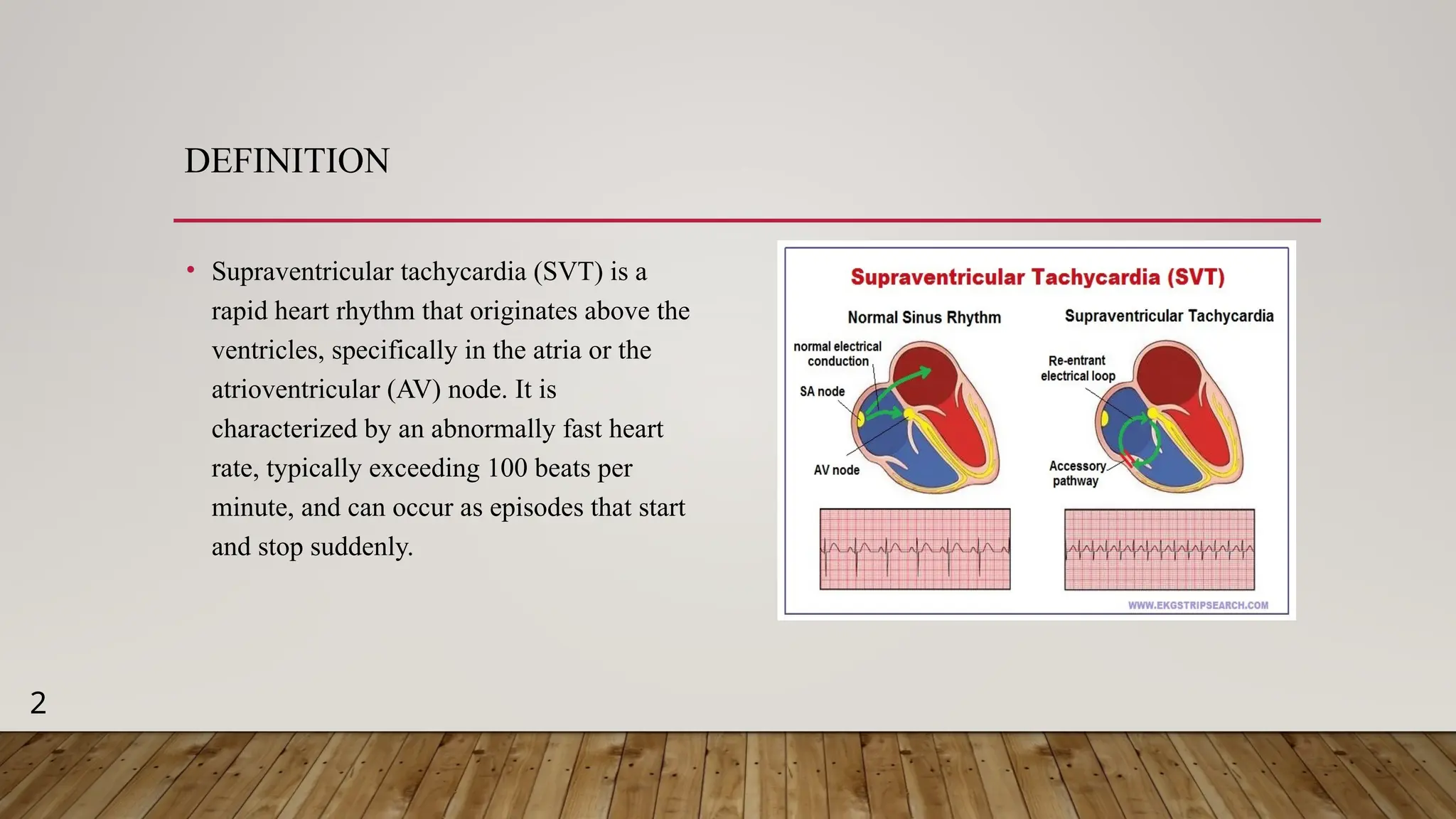 @CASE PRESENTATION ON SVT(SUPRA VENTRICULAR TACHYCARDIA.pptx