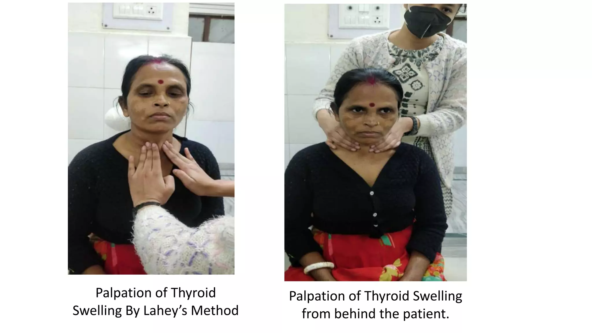 Case Presentation on Thyroid Swelling-2.pptx