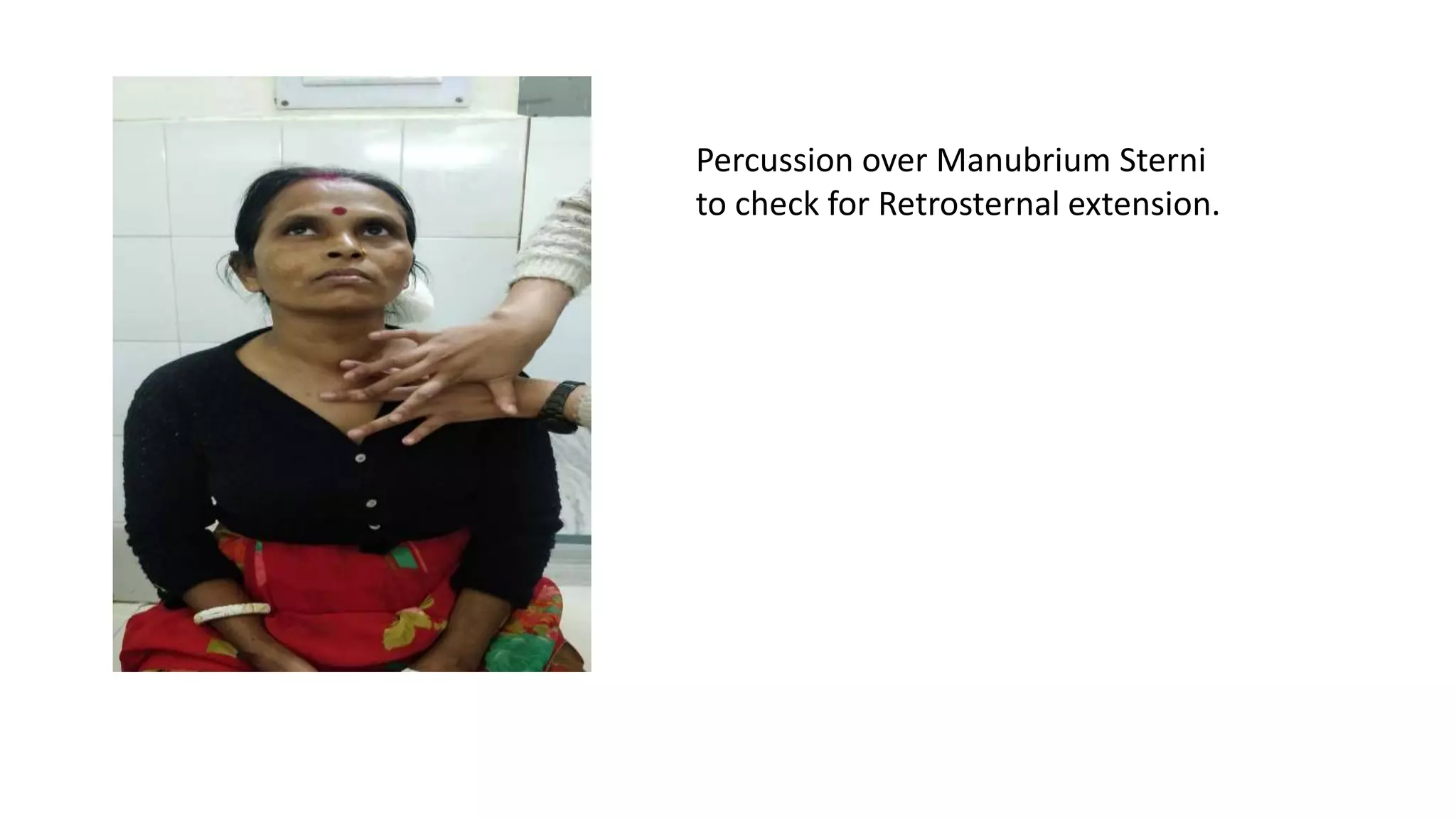 Case Presentation on Thyroid Swelling-2.pptx