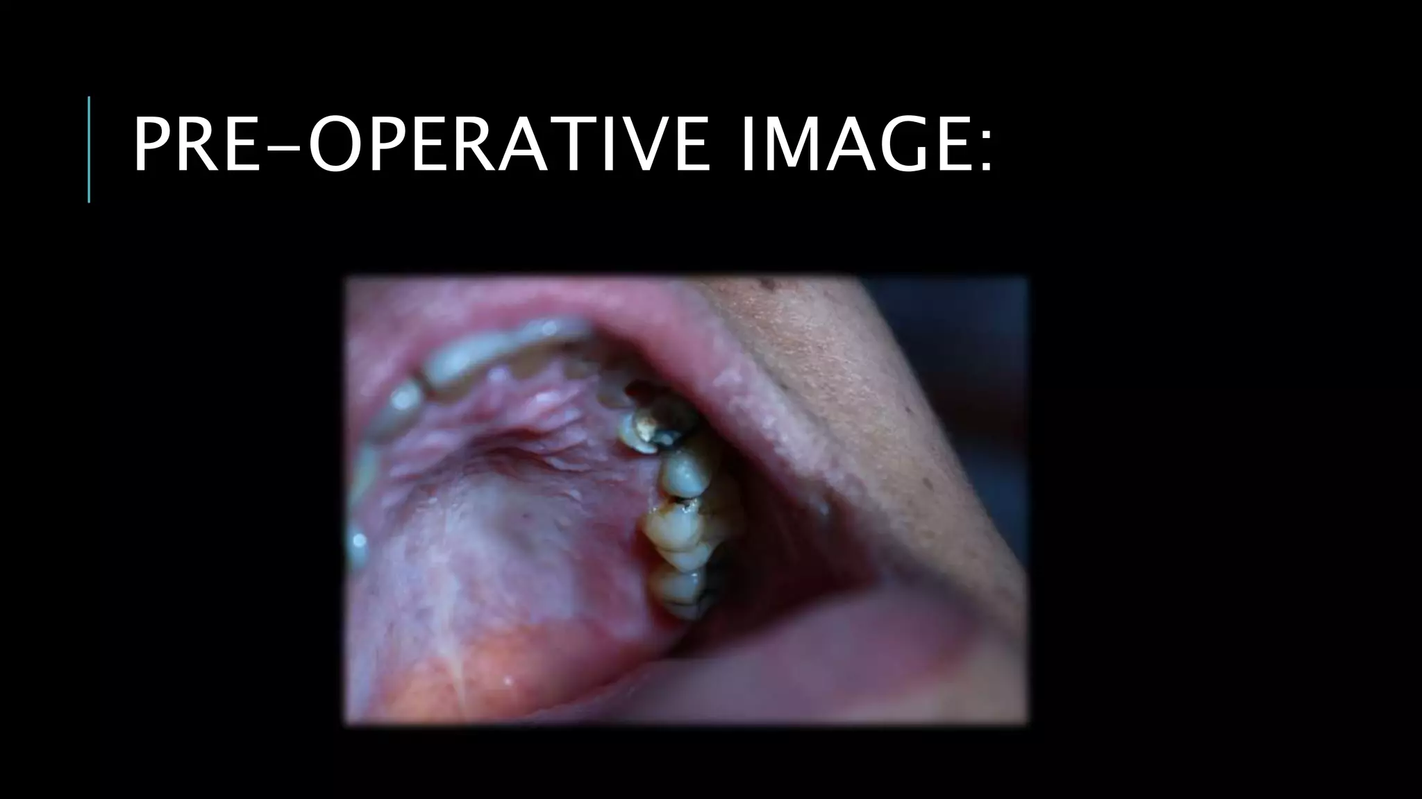 Operative " case presentation " | PPTX
