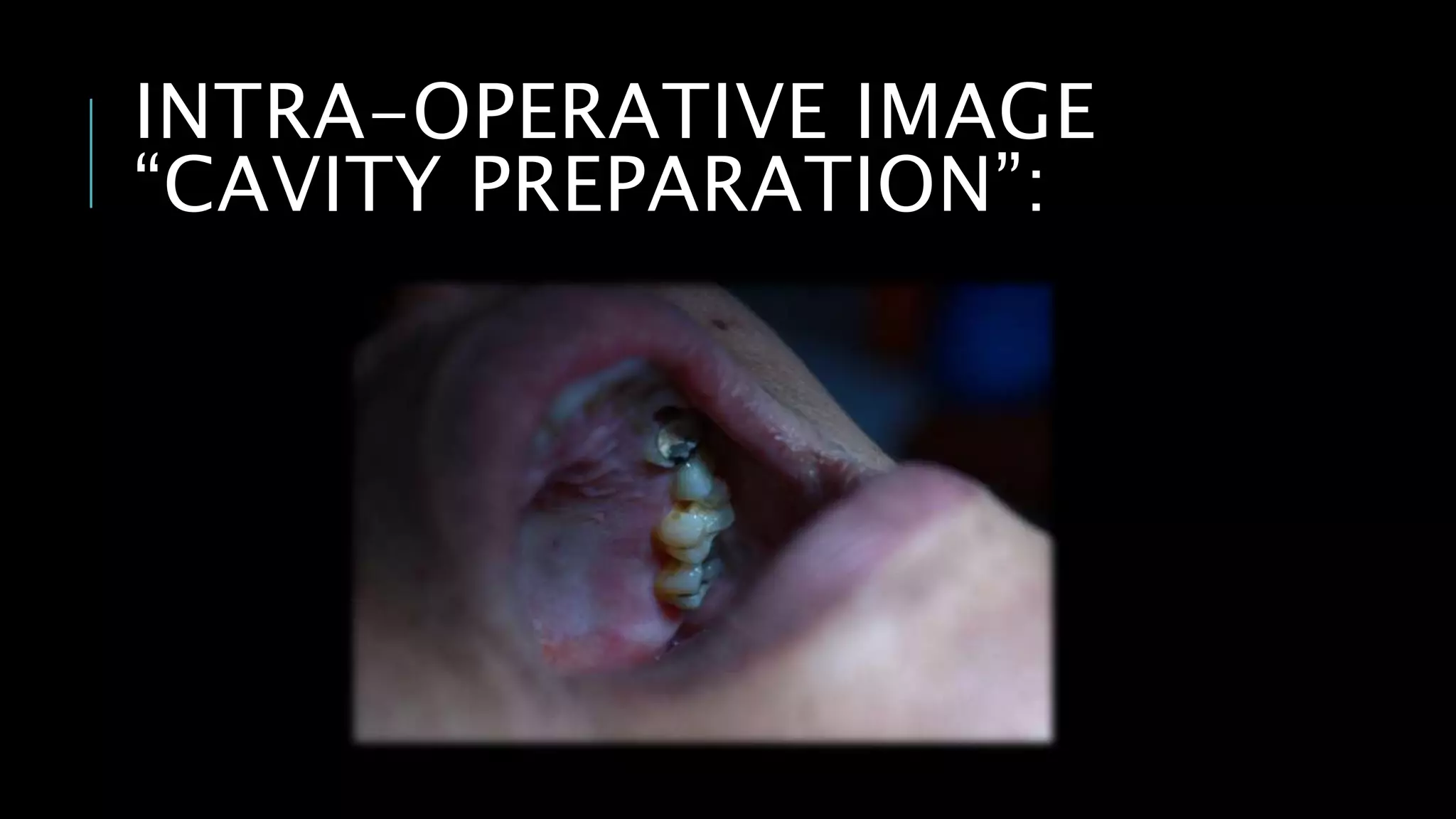 Operative " case presentation " | PPTX