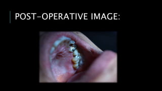 Operative " case presentation " | PPTX