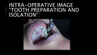 Operative " case presentation " | PPTX