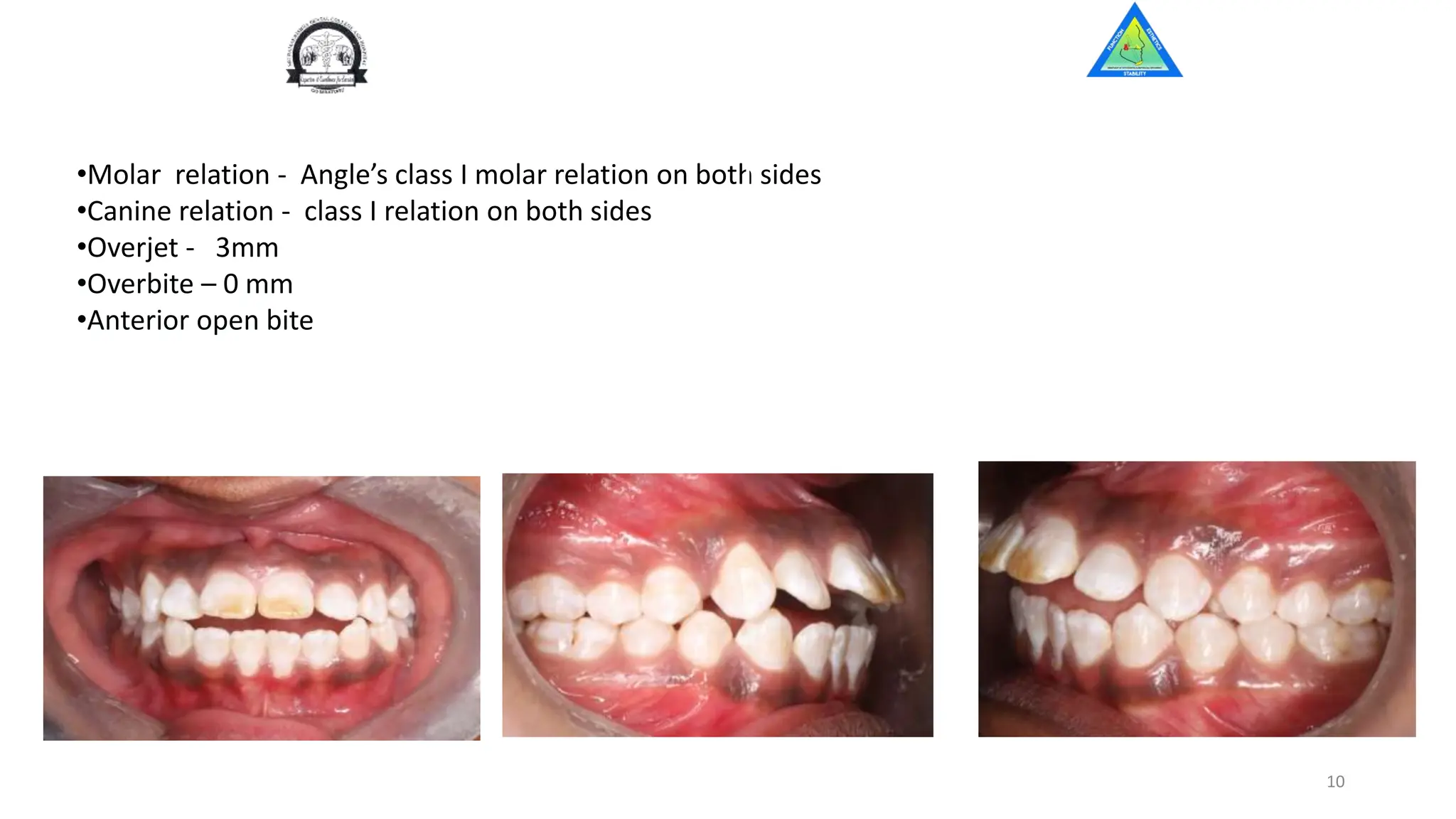 Anterior open bite,case presentation with treatment plan | PPTX