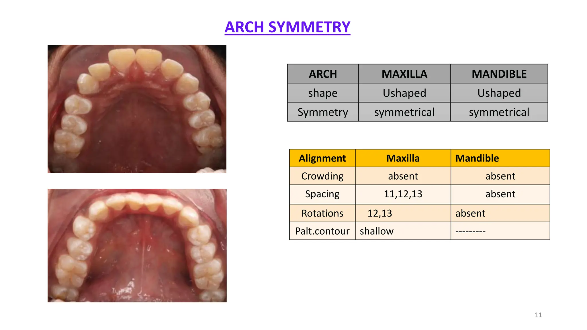 Anterior open bite,case presentation with treatment plan | PPTX