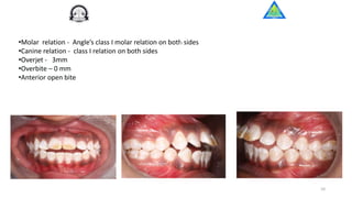 Anterior open bite,case presentation with treatment plan | PPTX