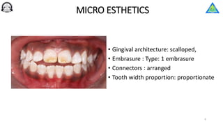 Anterior open bite,case presentation with treatment plan | PPTX